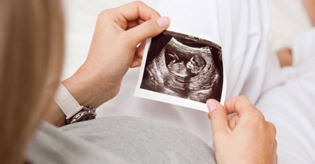 Anensefali Nedir? Anensefali Belirtileri Nelerdir? - Haber365