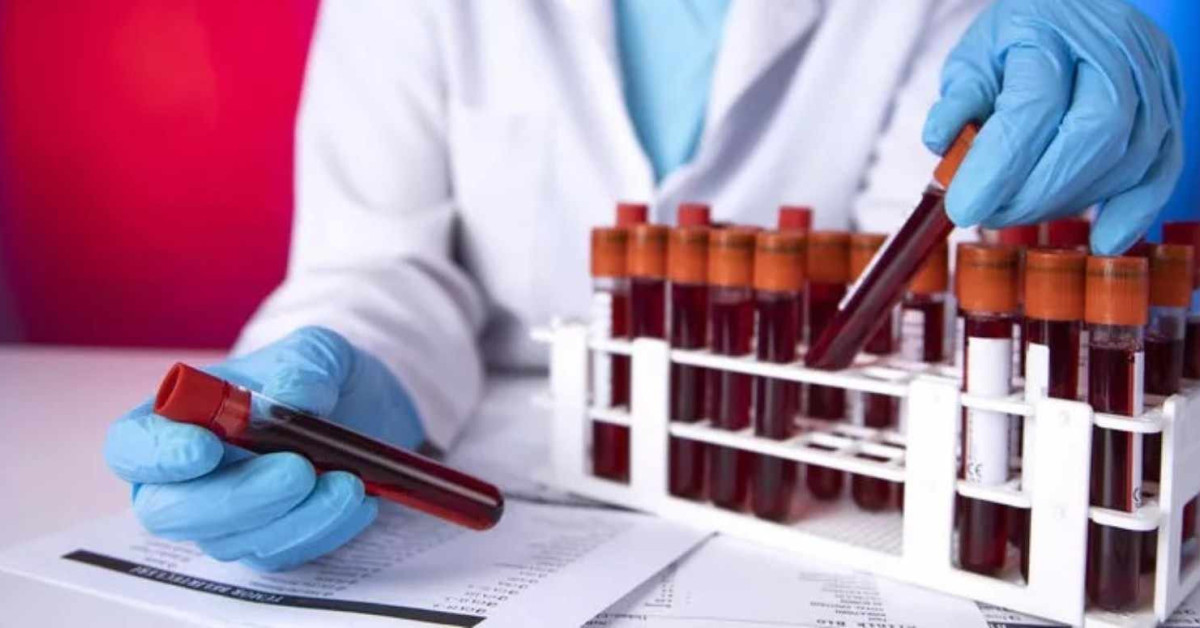 Lipaz değeri neden yükselir? Lipaz değerinin yüksek olmasını etkileyen ...